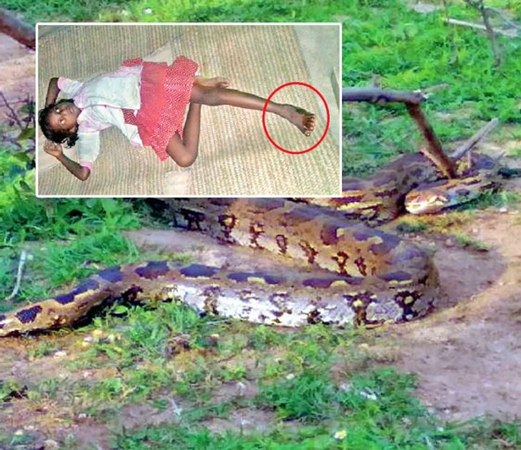 10 Year Old Girl Rescued From Python Jaw By Locals In Jharkhand ...