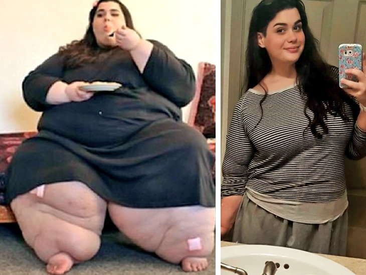 everyone is shocked as 300 Kg Woman Transformed Herself in 70 kg | Shocking : लठ्ठपणामुळे ...