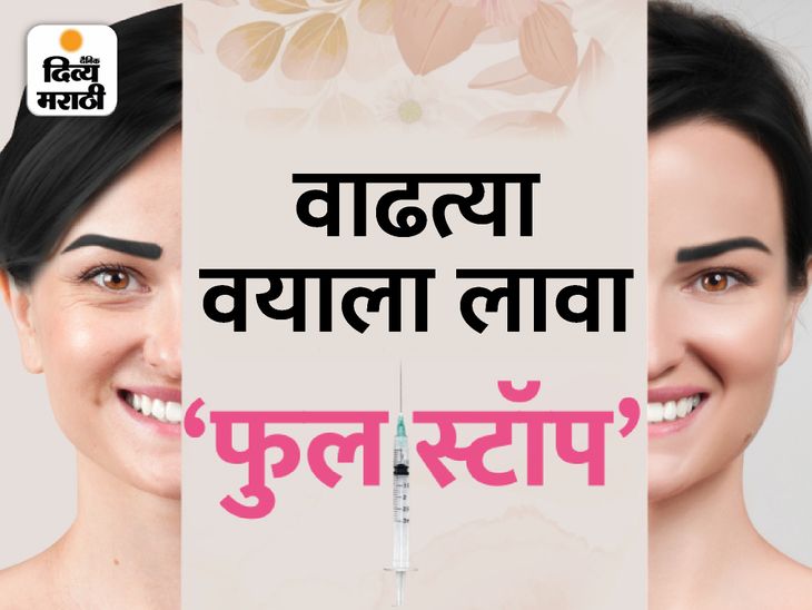 Botox Treatment Preparation; Botulinum Toxin Treatment Of The Upper Face