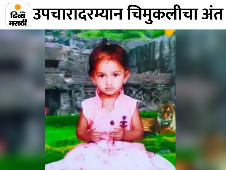 Death of 5-year-old girl after falling into boiling water, incident in ...