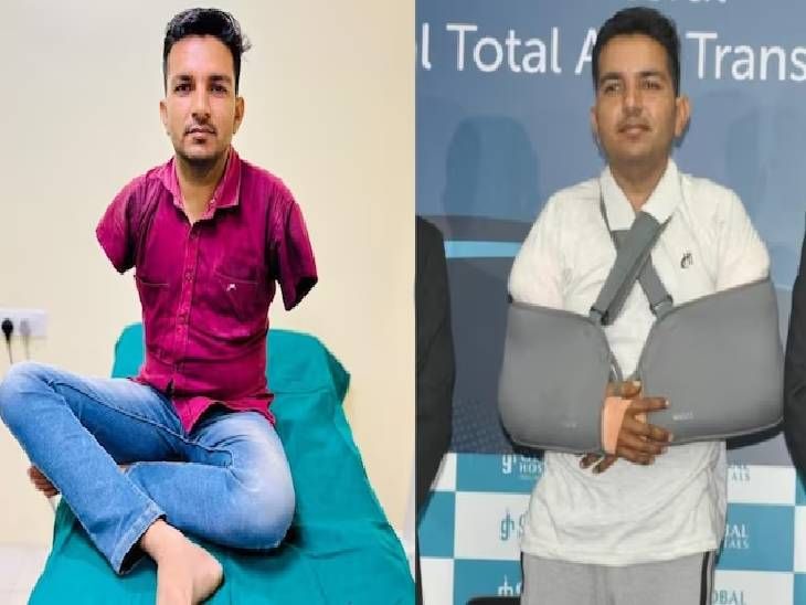 Rajasthan Man Total Arms Transplant Mumbai Hospital; Arm Replacement ...