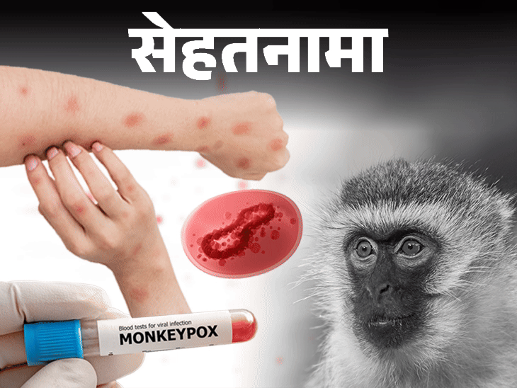 Africa Monkeypox Outbreak Symptoms Explained; Transmission