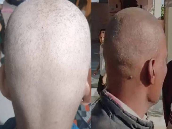 Buldhana Hair Loss Reasons Update Water Tds Level | Buldhana Takkal Viral