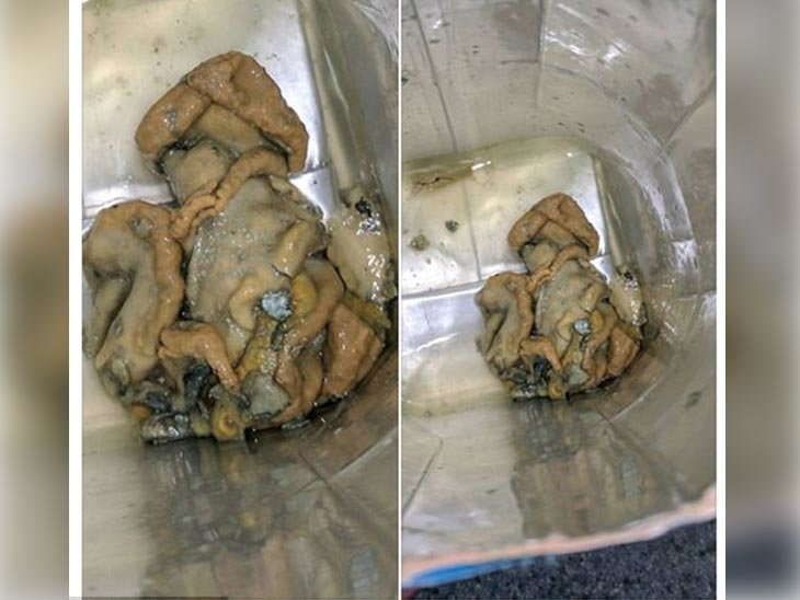 Woman drinking packet coconut water than vomiting after see inside the pack