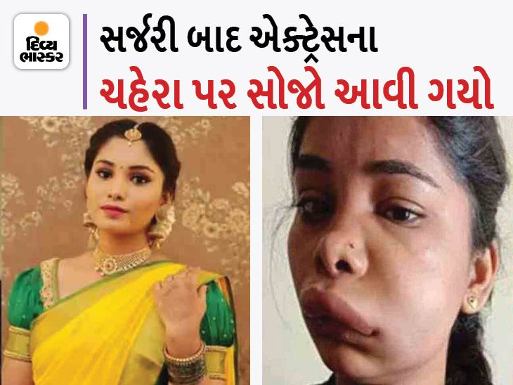 Kannada actress Swati Satish's face disfigured due to wrong surgery ...