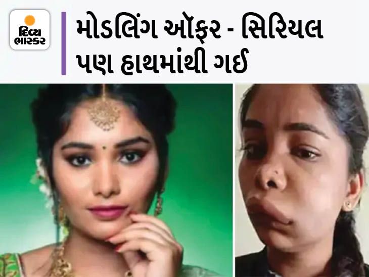Swati Satish stopped leaving home due to root canal surgery; The job ...