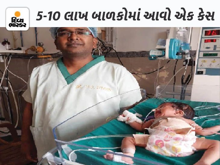 Successful operation of 23-day-old baby girl in Ranchi, doctor says ...