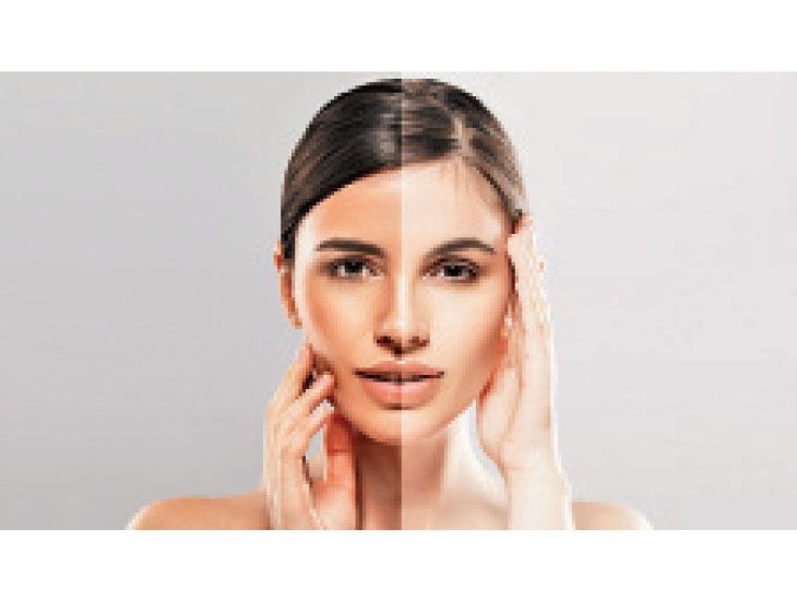 Home Remedies to Remove Tanning