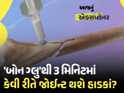 China Bone Glue Fracture Treatment Explained | Plaster Metal Rod