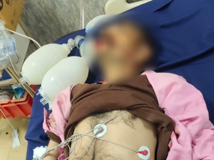 Gandhinagar Accident: Two Cousin Brothers Dead After Bullet Collision ...