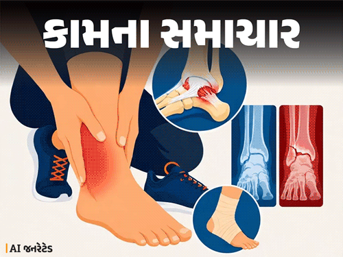 Foot Ankle Sprain: Simple RICE Therapy Guide, 7 Warning Signs to See a ...
