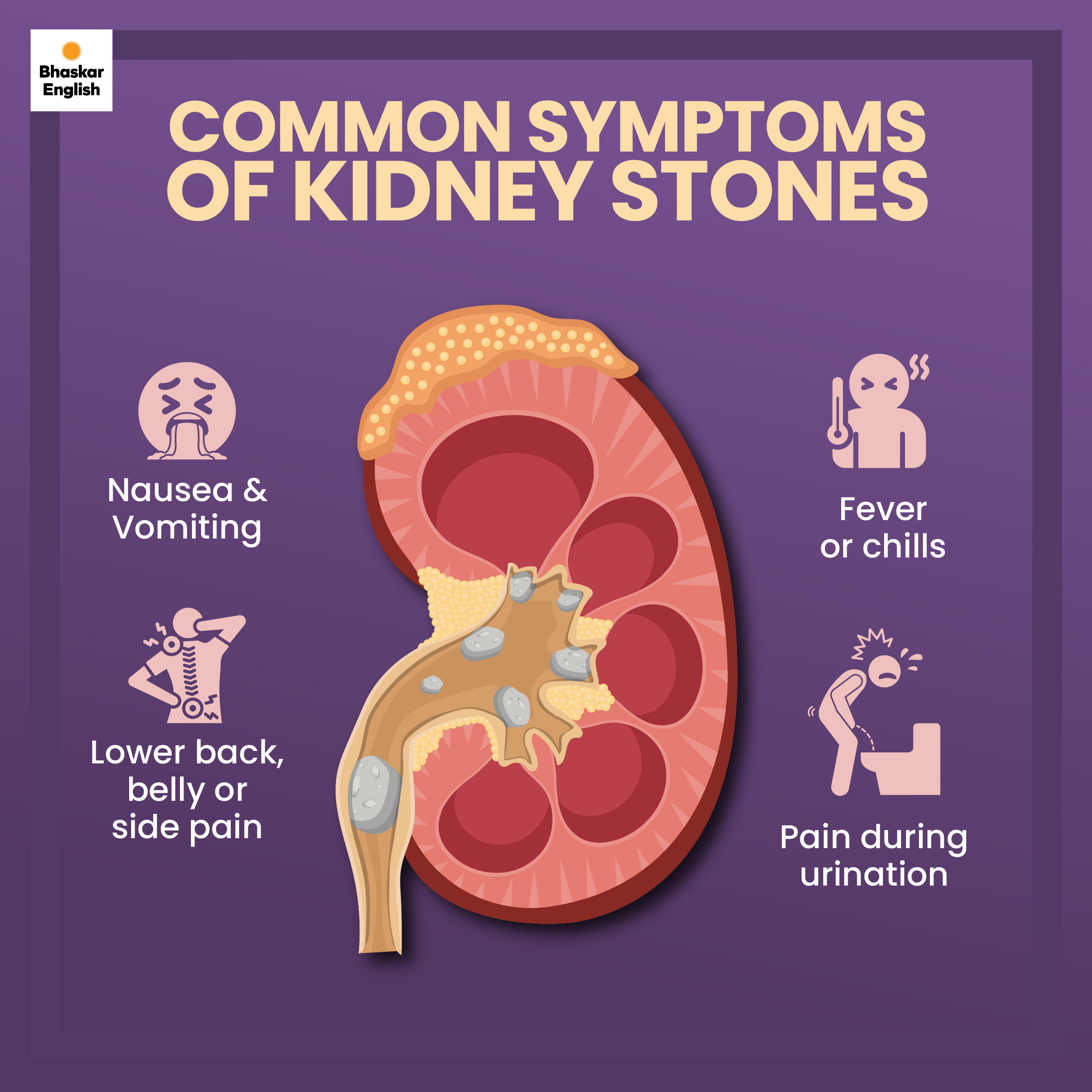 Can drinking less water leads to kidney stones know what does study ...