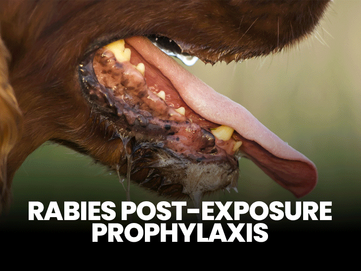 Emergence of rabies among vaccinated humans | Bhaskar English