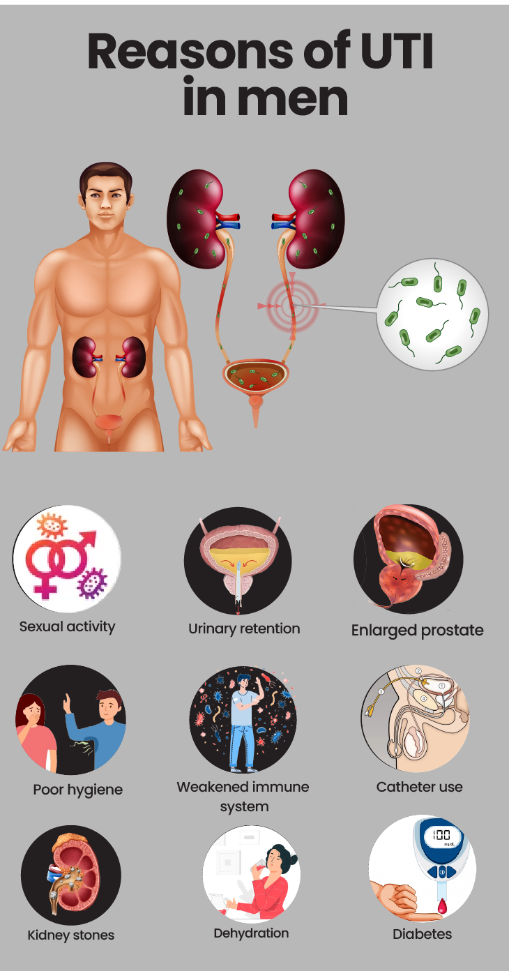 Urinary Tract Infection more dangerous in men, know the troublesome ...