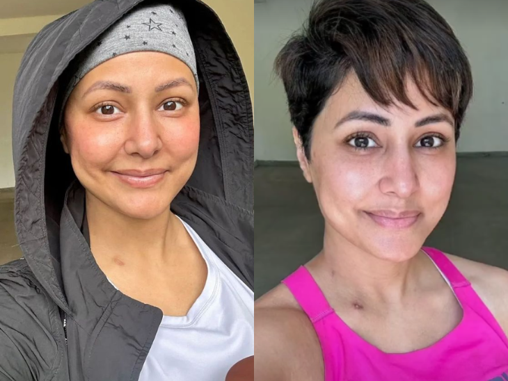 World Cancer Day Inspiring Stories hina khan sonali bendre tahira ...