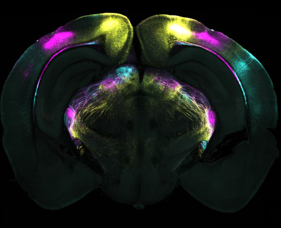 Scientists reveal how the brain overcomes fear-take a look at how ...