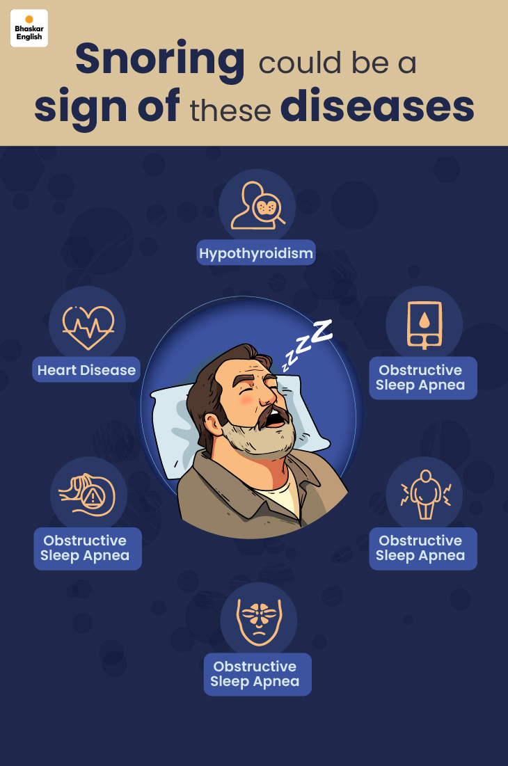 Snoring could be a sign of obstructive sleep apnea