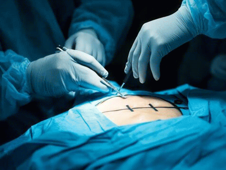 Avoid fried food and caffeine after gallbladder surgery | Bhaskar English