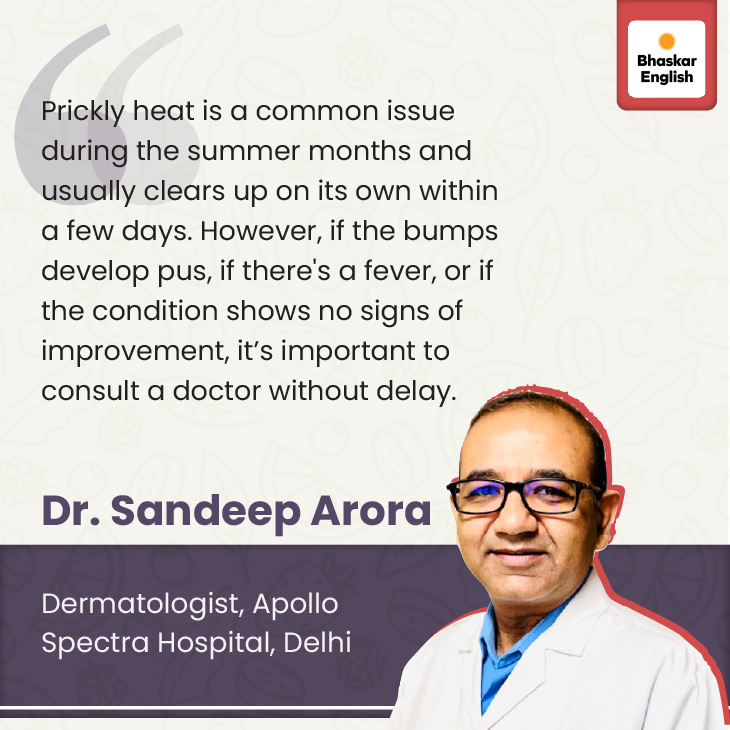 heat rash prickly heat symptoms causes children more likely to develop ...