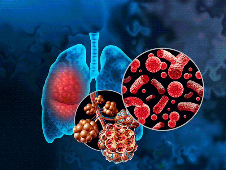 Increasing risk of pneumonia during monsoon