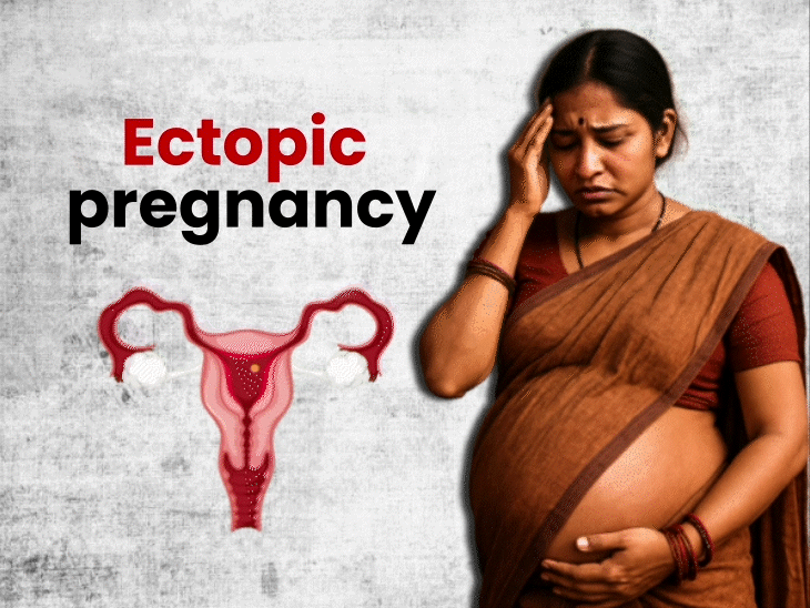Ectopic pregnancy poses deadly risk for women: Baby grows in fallopian ...