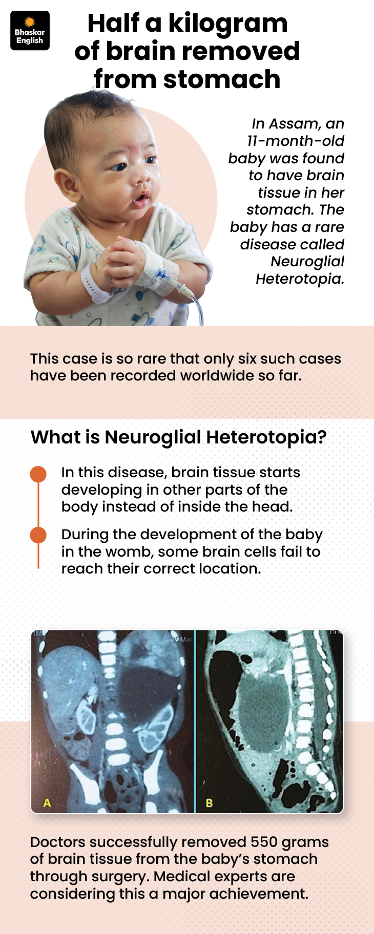 News With A Twist China spying on India through birds: Half‑kg brain ...