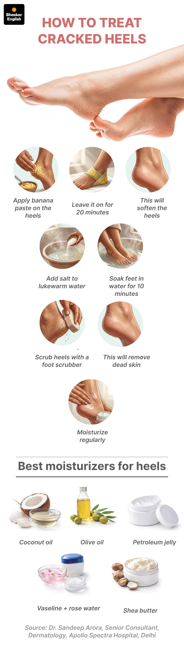 Are you suffering from cracked heels in Winters? | Bhaskar English