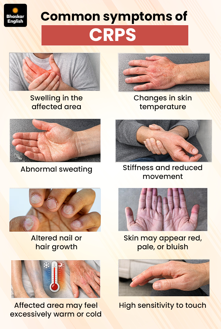Archana Puran Singh CRPS Explained | Wrist Injury Causes Symptoms