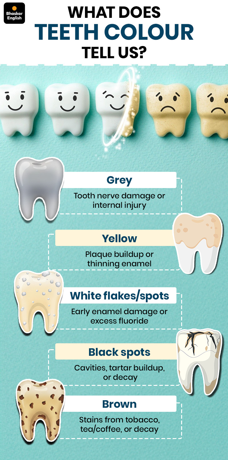Tooth Discoloration Explained: Diet & Deficiencies | Yellow Teeth Causes