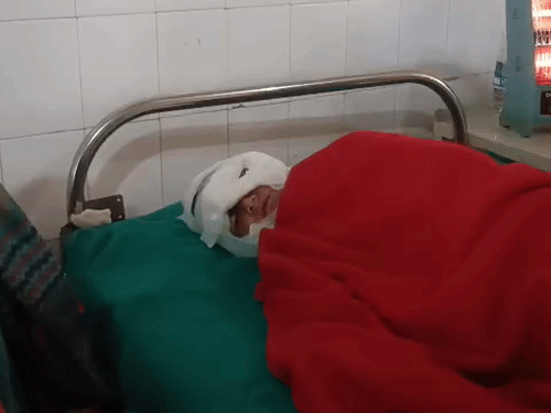 Pithoragarh Leopard Attack: Fathers Bravery Saves Child | Deep Claw ...