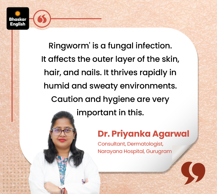 Ringworm Fungus: Doctor Explains Causes, Spread, Symptoms & Treatment