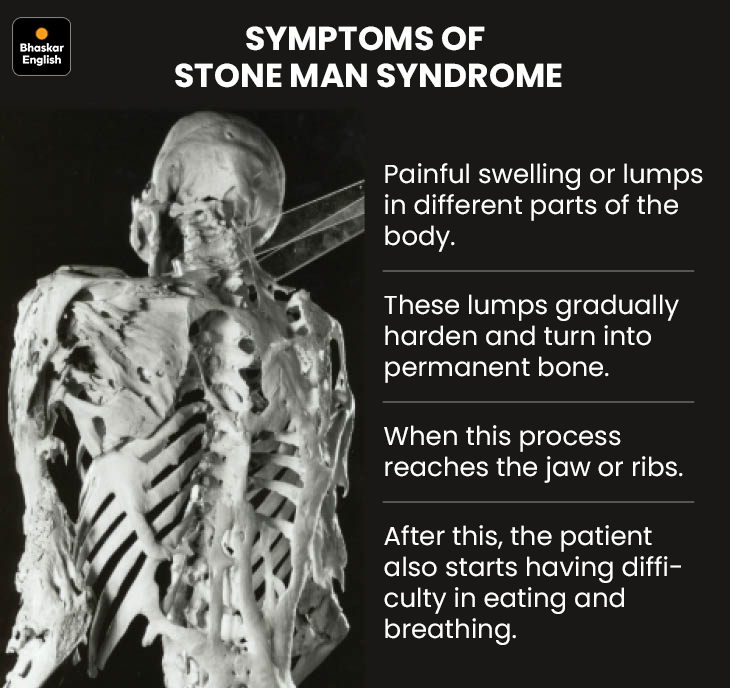 Rajasthan Child Diagnosed with Stone Man Syndrome | Rare Disease