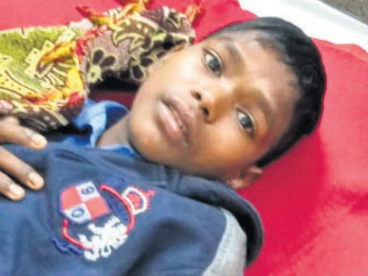 Rabies victim returned to doctors, CM called Raipur, but did not ...