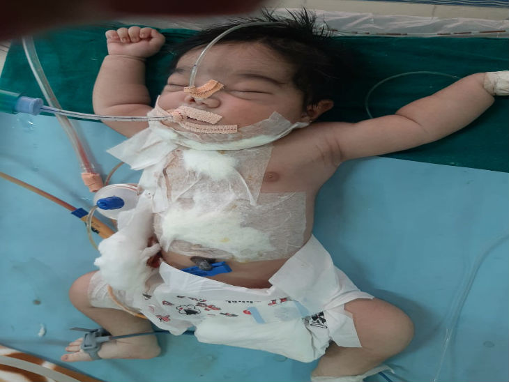 New Born Baby Died, found with multiple stab wounds In Indore | एक दिन ...