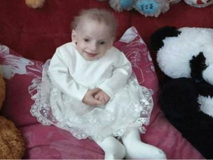 The 8-year-old girl died of progeria; Only 160 patients of this disease ...