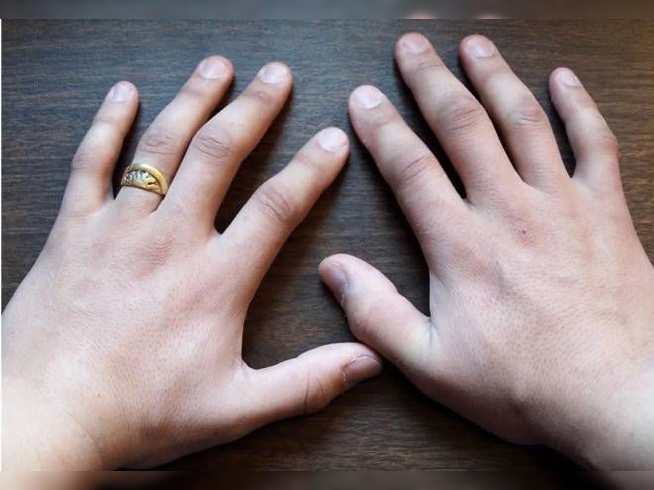 A study by the American Academy of Dermatology found that the blueness ...