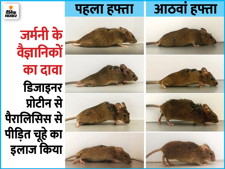 Paralysis Treatment; Germany Scientists Latest Research On Paralysis ...