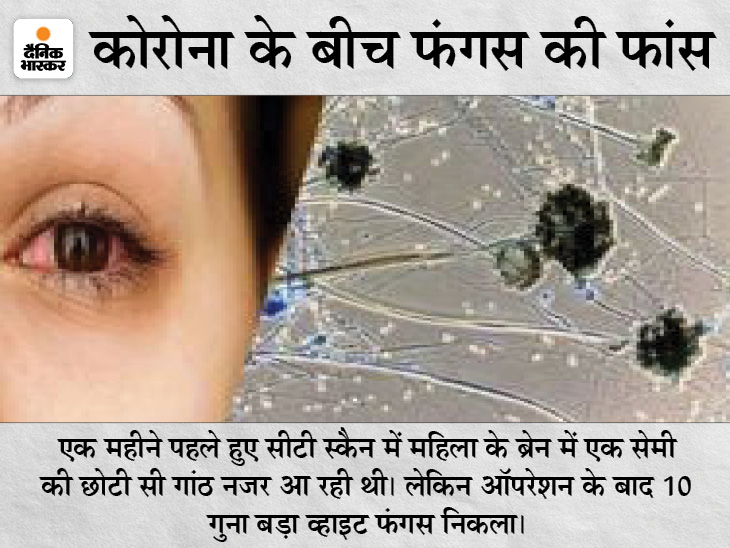 When the operation was done understanding the tumor, it was found that ...