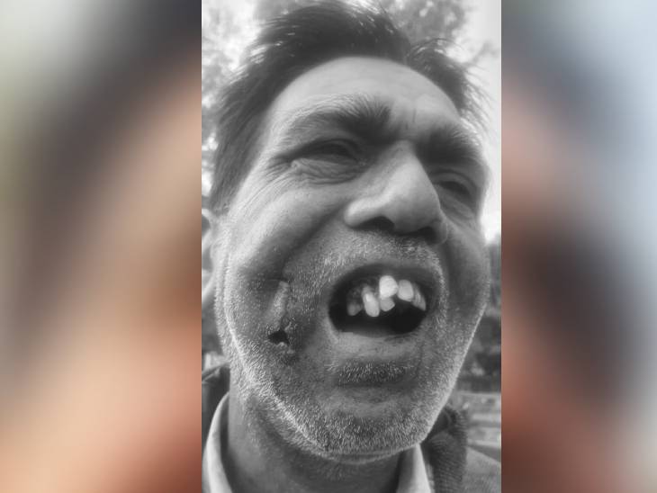 The young man along with his comrades beat him up; Cut the cheek with a ...