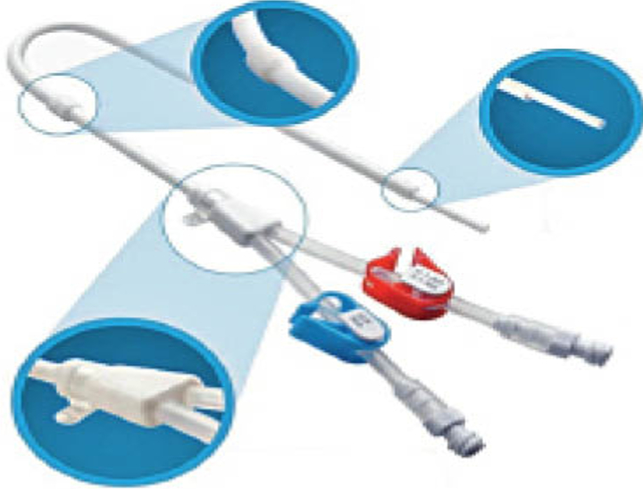 Permacath catheters, private hospitals charge up to ₹24 thousand free ...