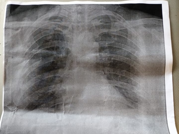 X-ray film not supplied for years, patient surprised to see report on ...