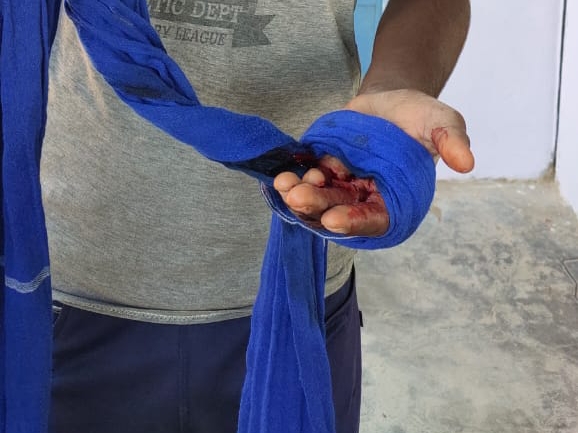 Accused attacked with sword, cut fingers, hand and leg injuries ...