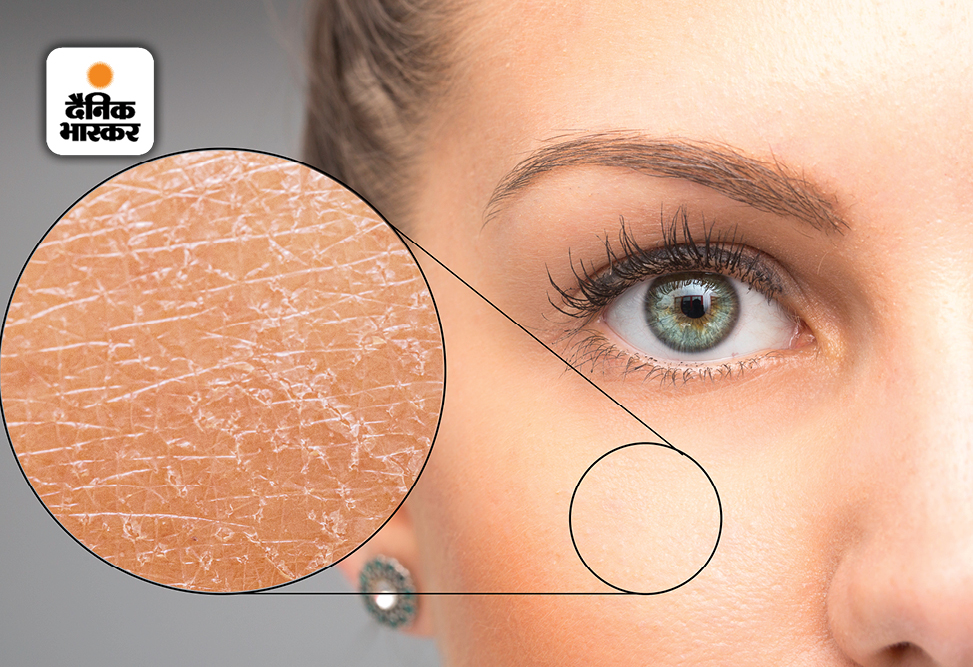 Fine lines, wrinkles, rashes can be bothersome, quick remedy will not ...