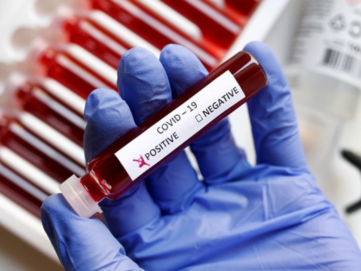 Sero test will be done to know immunity, now the positivity rate is 0.1 ...