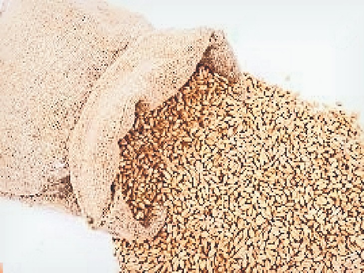 19.57 lakh families are not getting ration wheat because there is no ...