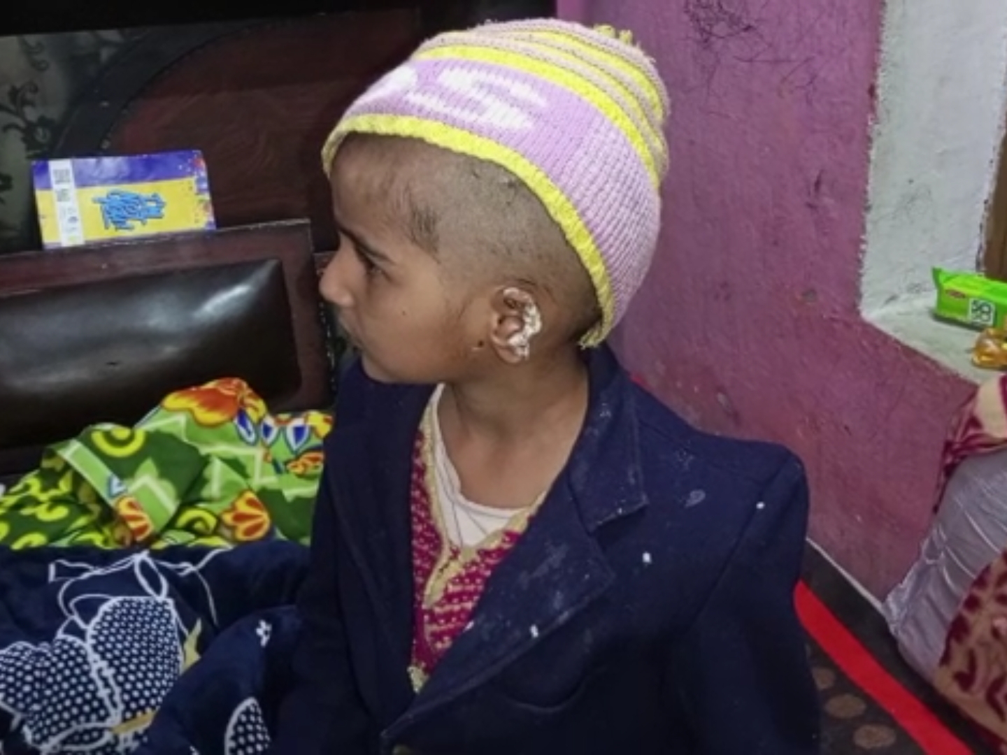 The whole ear was chewed off, the local people saved it, the dog owner ...