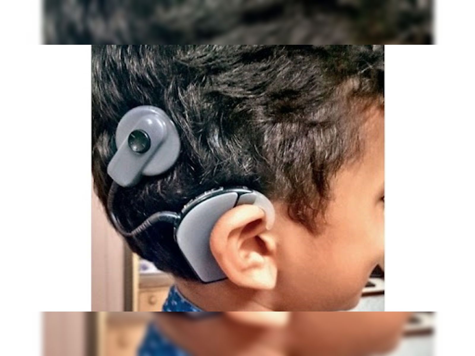 Inauguration of cochlear implant machine and affection meeting program ...