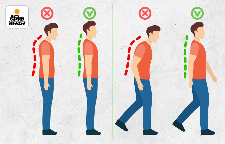 Body Posture Types Explained; How to Improve Posture For Healthy Back ...