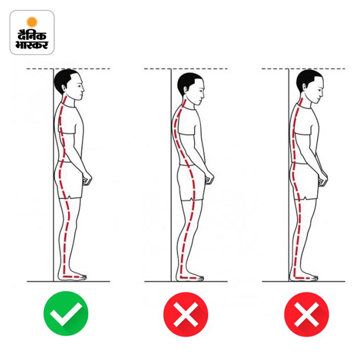 Body Posture Types Explained; How to Improve Posture For Healthy Back ...