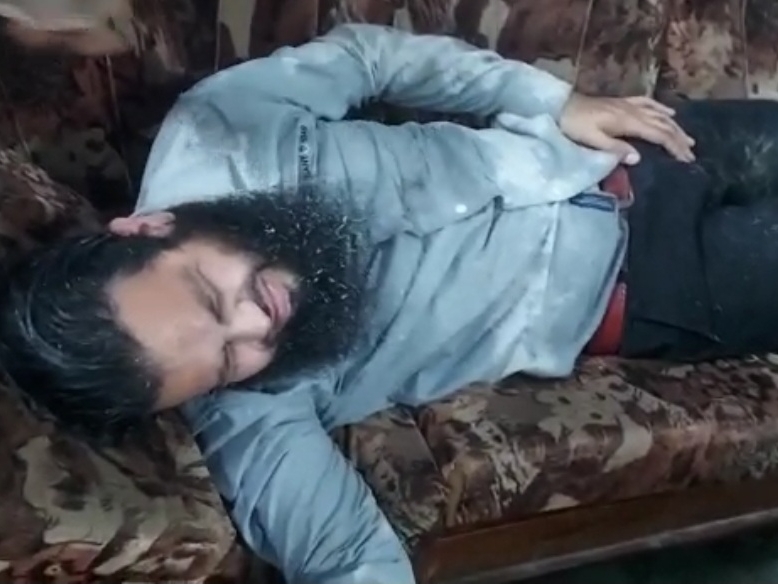 Coffee machine explodes, one person seriously injured, workers admitted ...